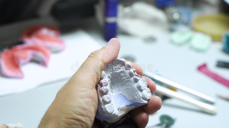 Dental Technician Creates Dental Prostheses. Laboratory. Close-up ...