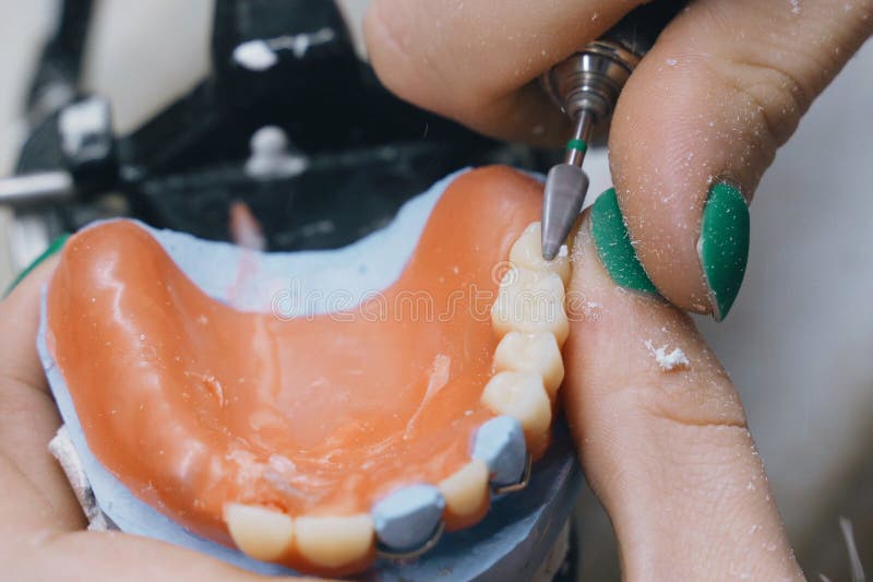 A Dental Technician Cleans Dentures with a Milling Cutter in the ...