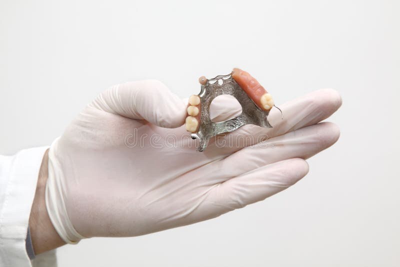 Dental imprint stock photo. Image of plastic, tooth, material - 9683194