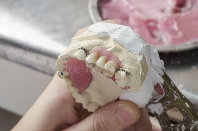 Dental Technician Doing Partial Dentures of Acrylic Resins. Stock Image ...