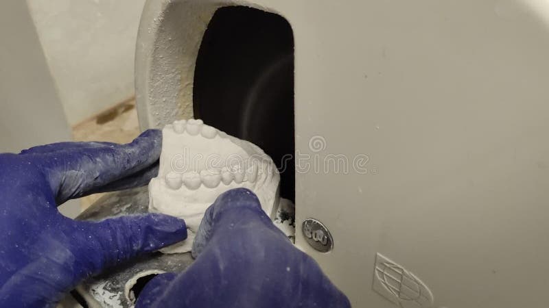 Dental Technician Grinding a Gypsum Cast of Teeth Stock Video - Video ...