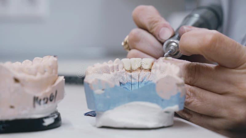 Dental Technician Grinding a Tooth Model Stock Footage - Video of ...