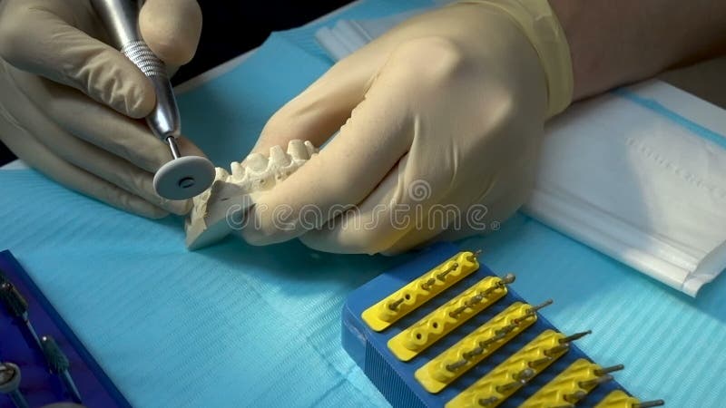 Preparation of Teeth for Prosthetics. the Use of Anesthesia in ...