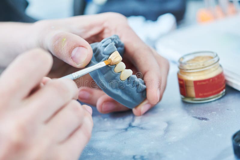 Dental Technician Work. Prosthesis Production. Teeth Prototype ...