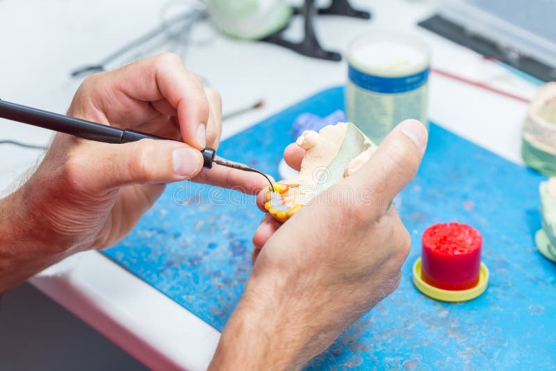 Dental Technician Modeling a Wax Bridge Stock Image - Image of oral ...