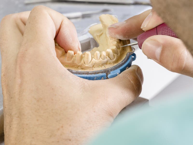 Dental Technician Modelling an Implant Ceramic Tooth with a Drill Stock ...