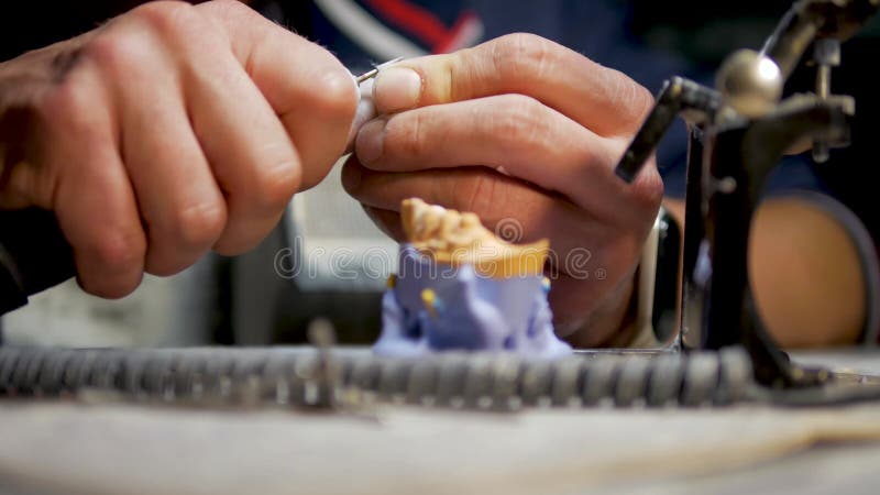 Dental Technician Work,teeth Sharpening,denture Milling,ceramic Tooth ...