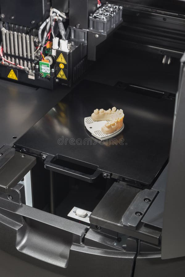 Dental Technician Working on 3D Printed Mold for Tooth Implants Stock ...