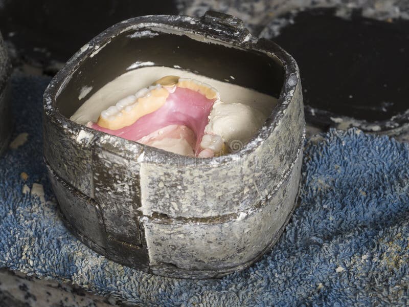 Dental Technician is Working with a Dental Flask of a Complete U Stock ...