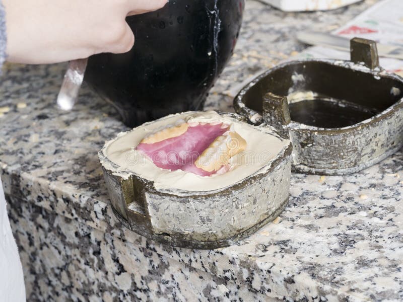 Dental Technician is Working with a Dental Flask of a Complete U Stock ...