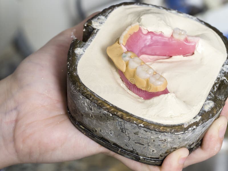 Dental Technician is Working with a Dental Flask of a Complete U Stock ...