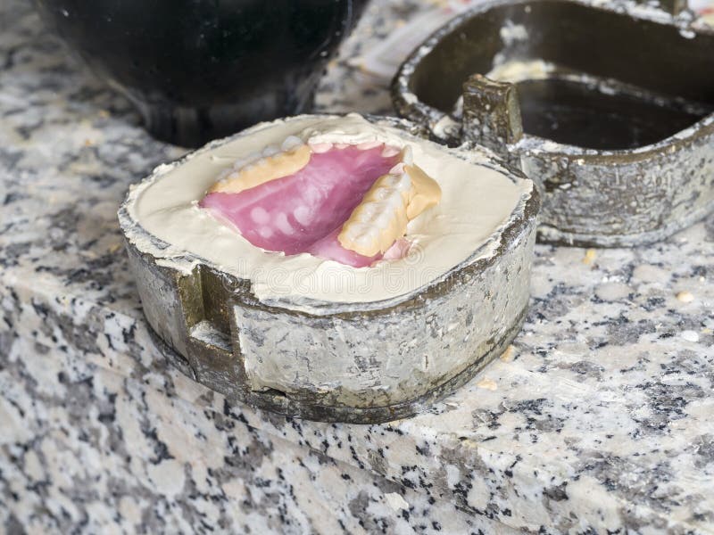 Dental Technician is Working with a Dental Flask of a Complete U Stock ...