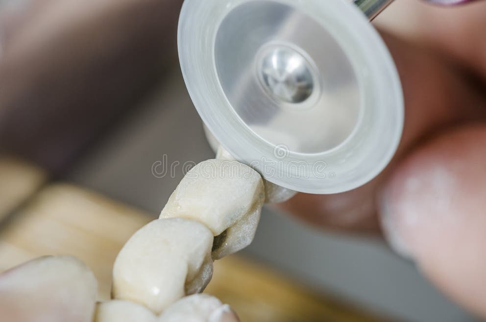 Dental Technician Working with Diamond Discs. Stock Image - Image of ...