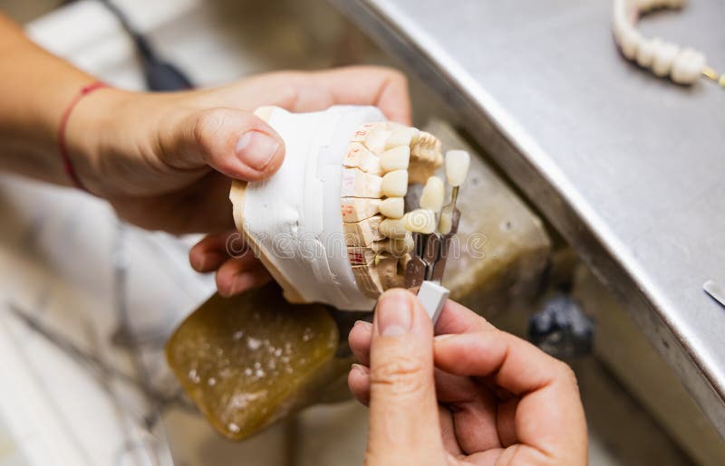 Dental Technician Working with Tooth Prosthesis Mold Stock Photo ...