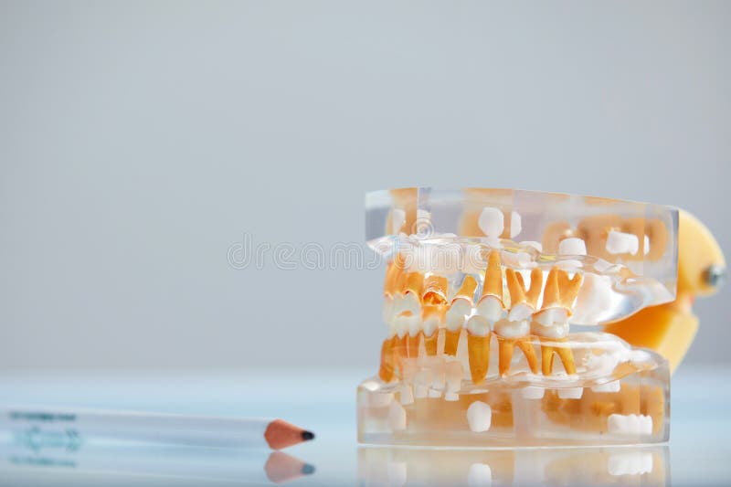 Dental Teeth 3d Transparent Model of Jaw Stock Image - Image of tooth ...