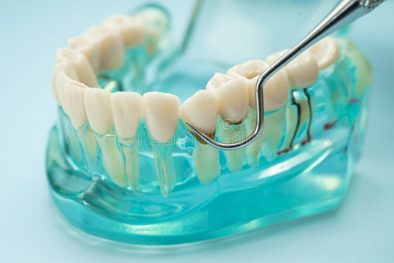 Dental Teeth Model with Dentist Tool for Dentistry Stock Photo - Image ...