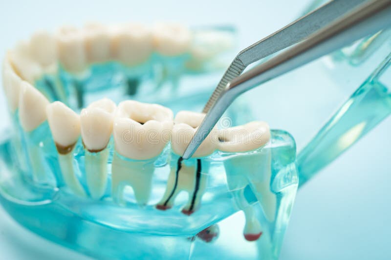 Dental Teeth Model with Dentist Tool for Dentistry Stock Image - Image ...