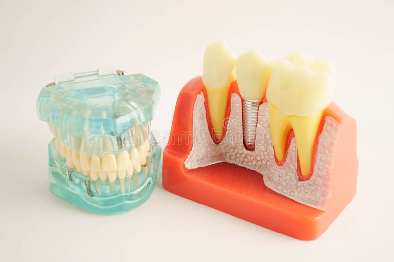 Dental Teeth Model on White Background for Learn about Dentistry Stock ...