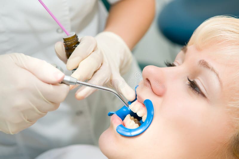 Dental teeth treatment stock image. Image of mouth, equipment - 16642121