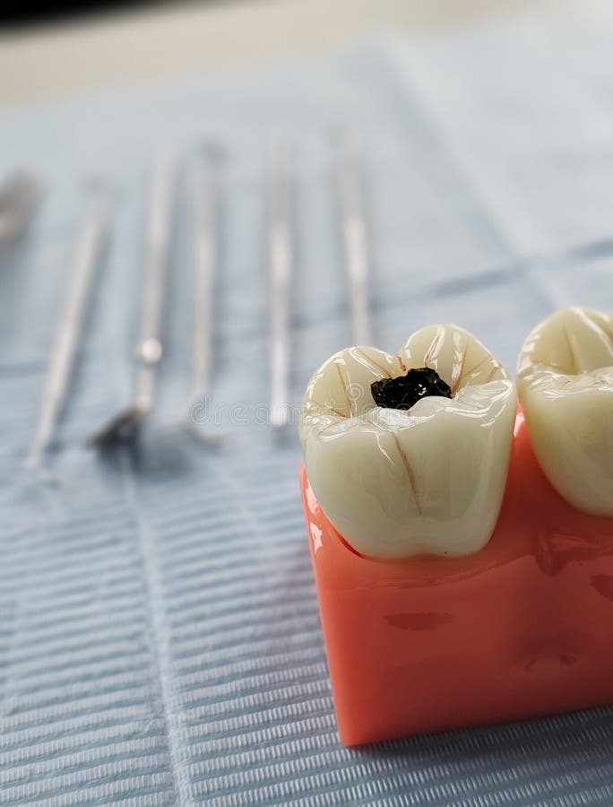 Dental Tools and Model Teeth Displayed on a Blue Surface Stock Image ...