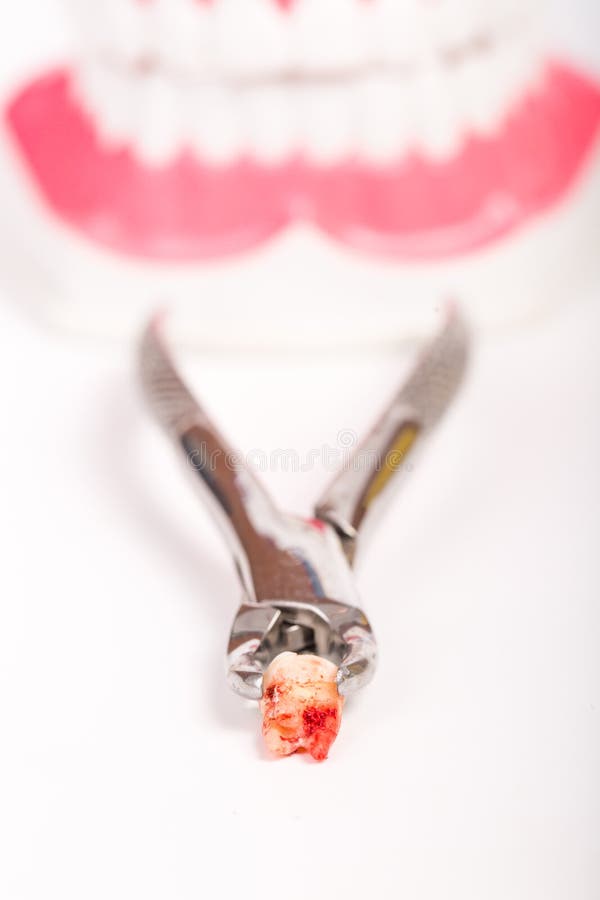Dental Tools and Remove Tooth at Clinic Isolated Stock Image - Image of ...