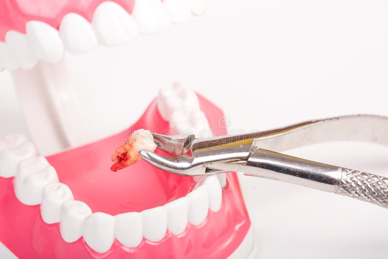 Dental Tools and Remove Tooth at Clinic Isolated Stock Image - Image of ...