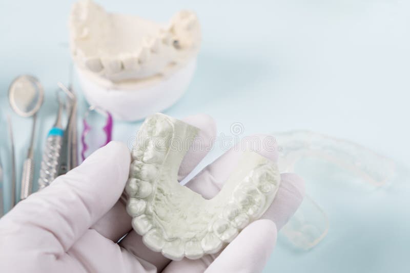 Dental tools and retainer. stock photo. Image of care - 115639746