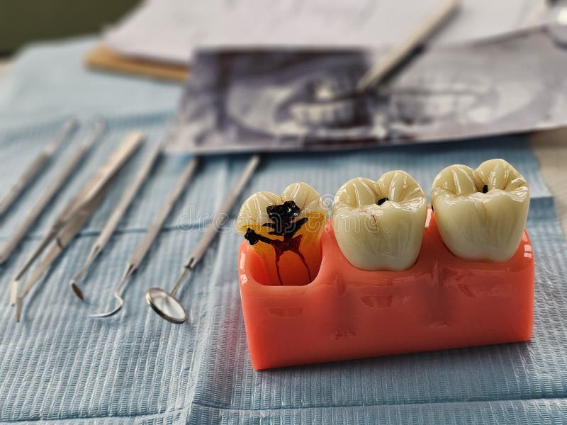 Dental Training Model with Various Dental Instruments Stock Photo ...