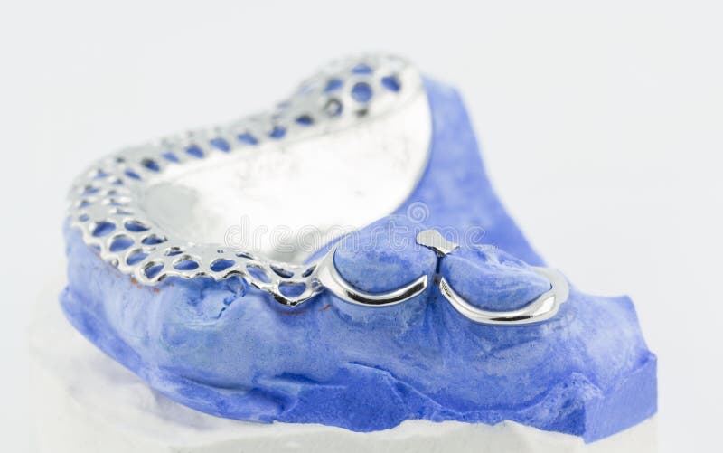 Dental Wire Bending for Make a Partial Denture Stock Image - Image of ...