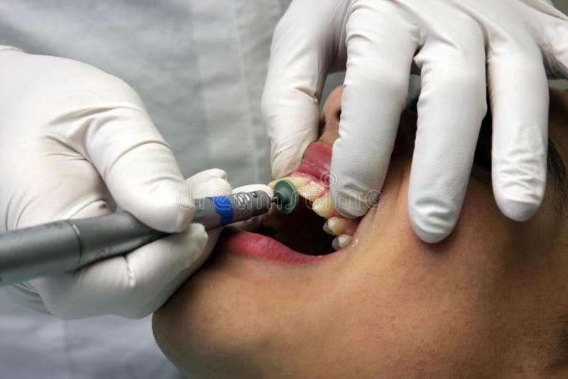Dental work stock image. Image of hands, polished, dental - 4236339