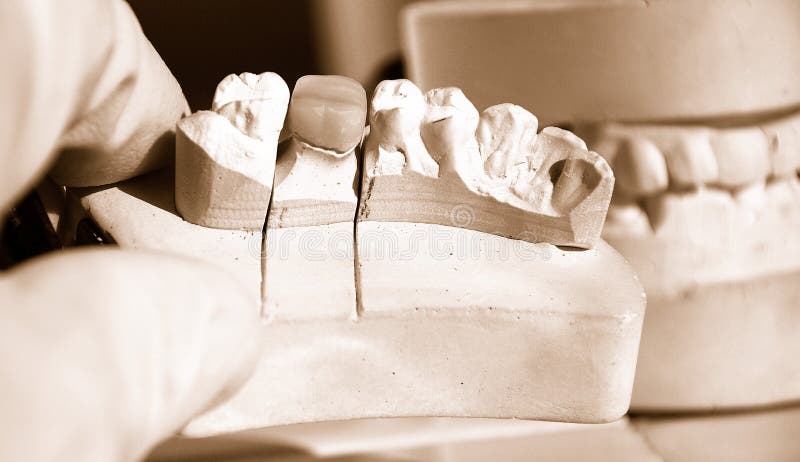 Dental Work stock image. Image of technician, technology - 4717155