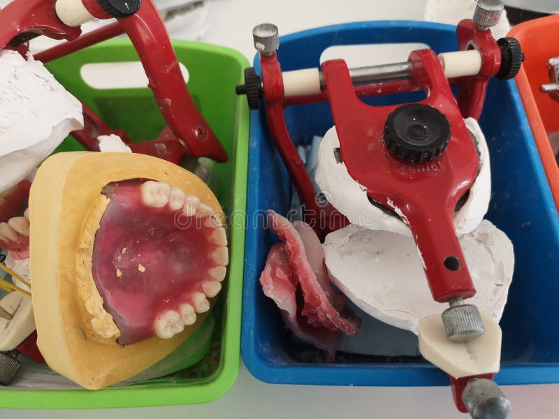 Dental Work Cast Denture Construction- Stock Image - Image of dental ...