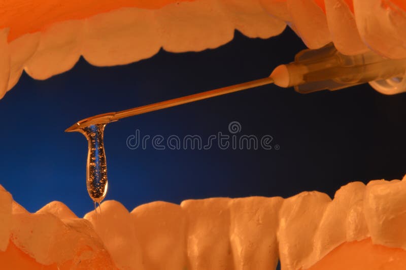 Hypodermic Needle Making Injection into Gum Stock Photo - Image of ...