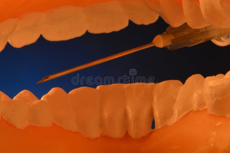 Hypodermic Needle Making Injection into Gum Stock Photo - Image of drug ...