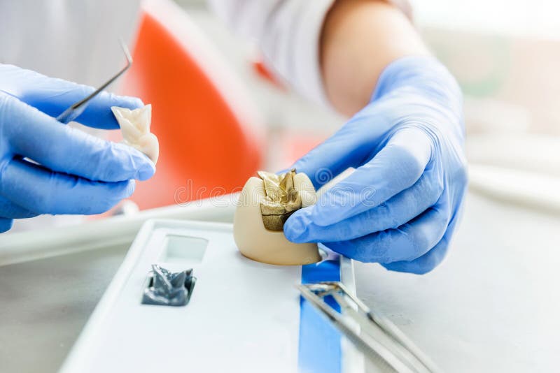 Dental Work on Tooth Model. Close Up Stock Image - Image of equipment ...