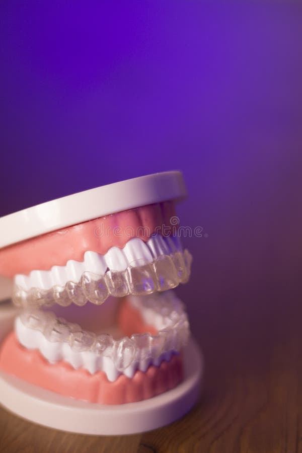 Dentier Avec Des Orthodonties Transparentes Image stock - Image du ...