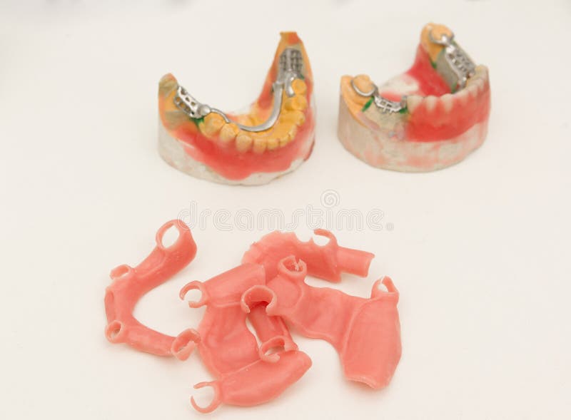 Dentiers photo stock. Image du médecine, prothèse, impressions - 36679714