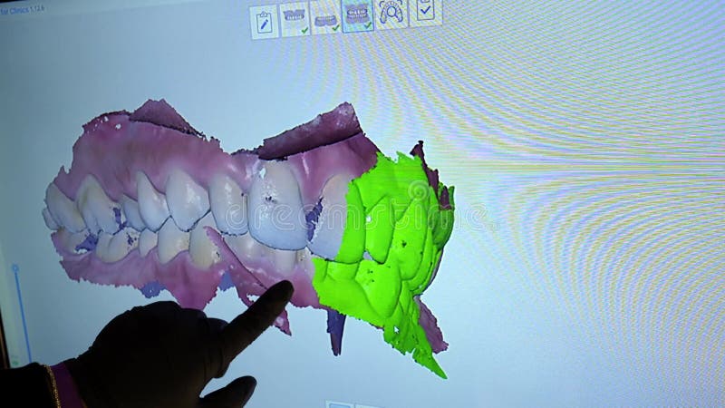 Dentist Analyzing 3d Scan of Teeth on Computer Stock Video - Video of ...