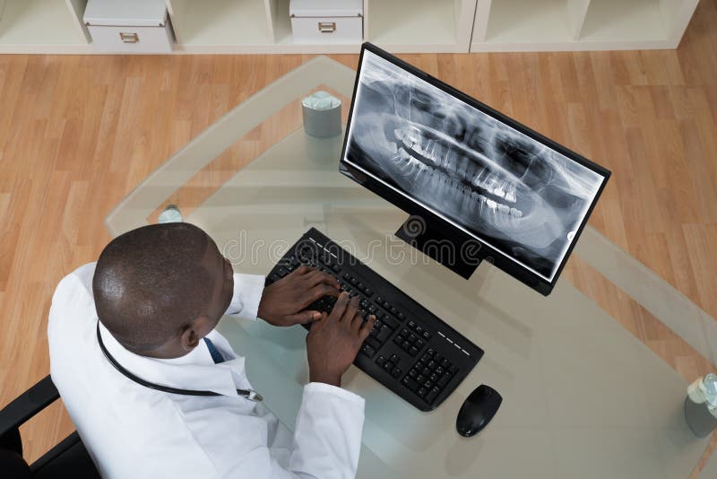Dentist Analyzing X-ray Teeth on Computer Stock Image - Image of ...
