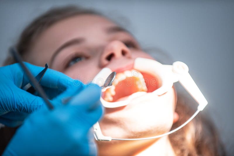 Dentist Appointment at a Dental Clinic, Placing Braces Locks on the ...