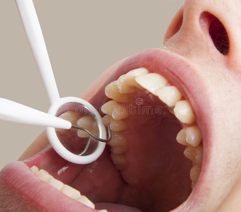 The dentist check stock photo. Image of open, clinic - 106838858