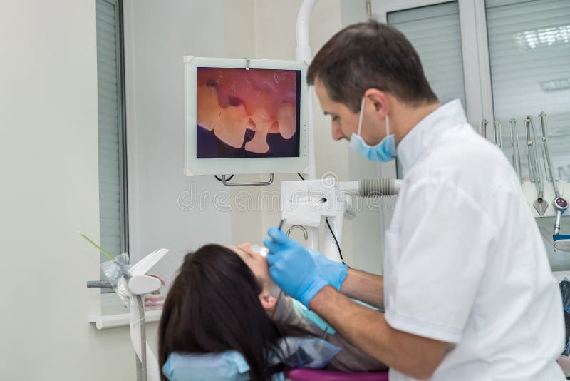 Dentist Checking Patient`s Teeth with Camera in Stomatology Stock Image ...