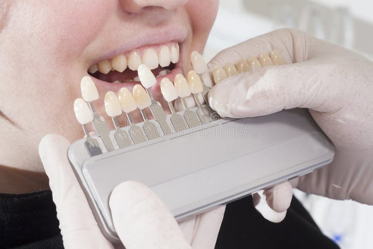 Dentist Choose White of Teeth Stock Image - Image of medical ...