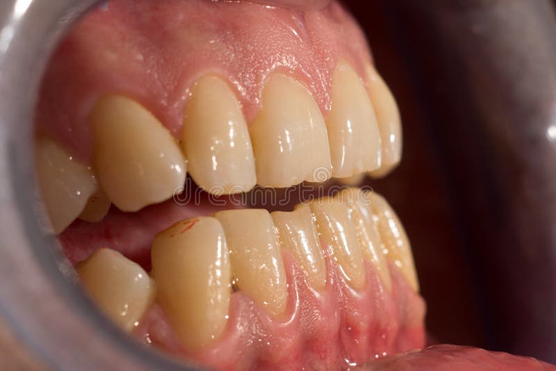 At the dentist stock photo. Image of open, profile, showing - 71147052