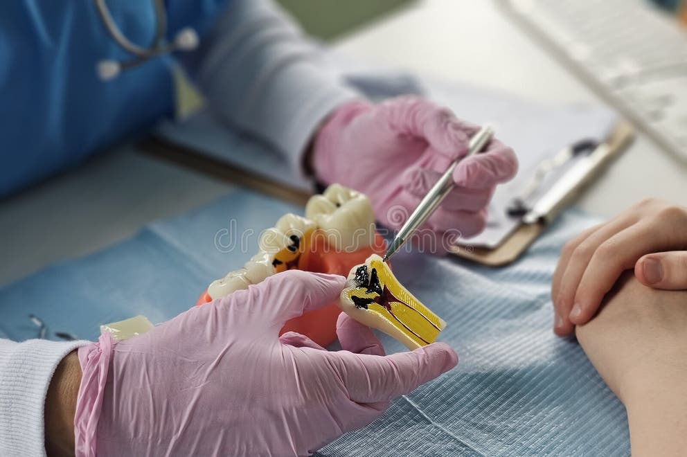 Dentist Demonstrates Dental Procedures Using a Model in a Clinic Stock ...