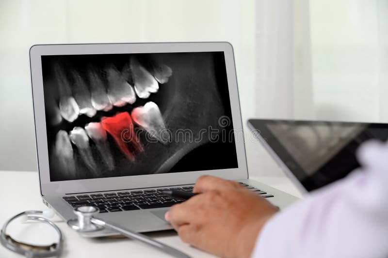 Dentist Dental Tool To Teeth X-ray Work Looking at Teeth X-ray on ...