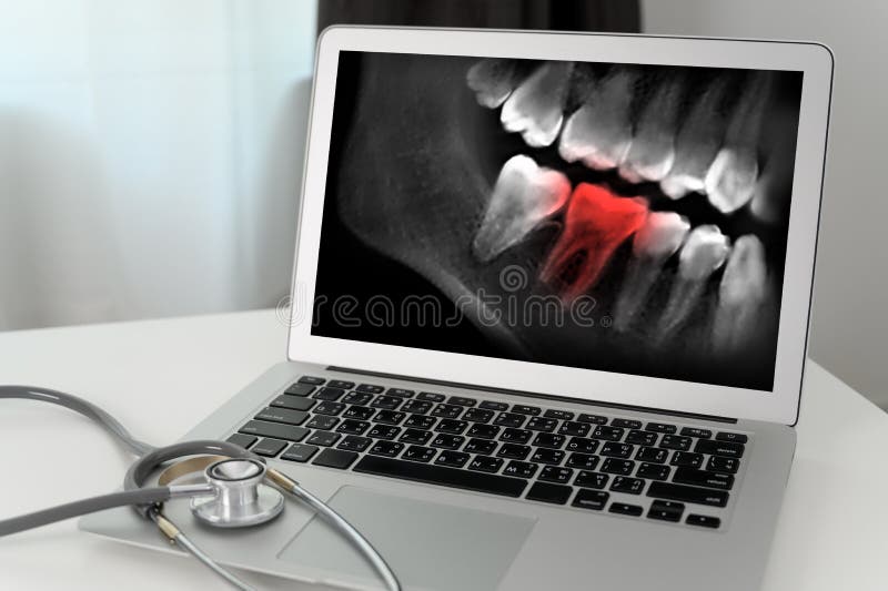 Dentist Dental Tool To Teeth X-ray Work Looking at Teeth X-ray on ...