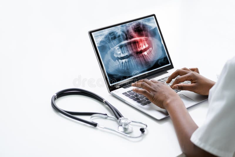 Dentist Doctor Looking at Teeth Xray Stock Photo - Image of healthcare ...