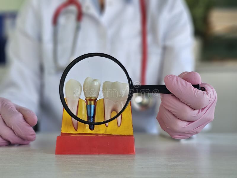 A Dentist Examines a Dental Implant Model Under Magnification in a ...