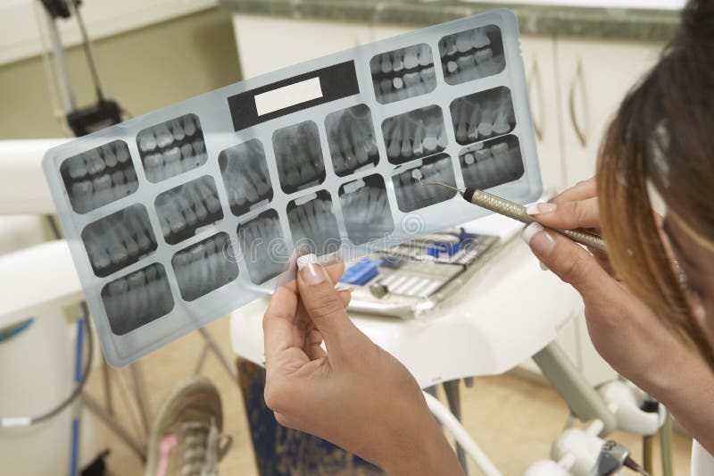Female Dentist Examining Jaw Xray on Computer in Clinic Stock Photo ...
